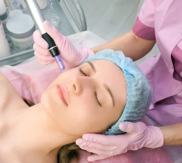 Dermaplaning & Microneedling Combined - Exmouth – Train You Academy